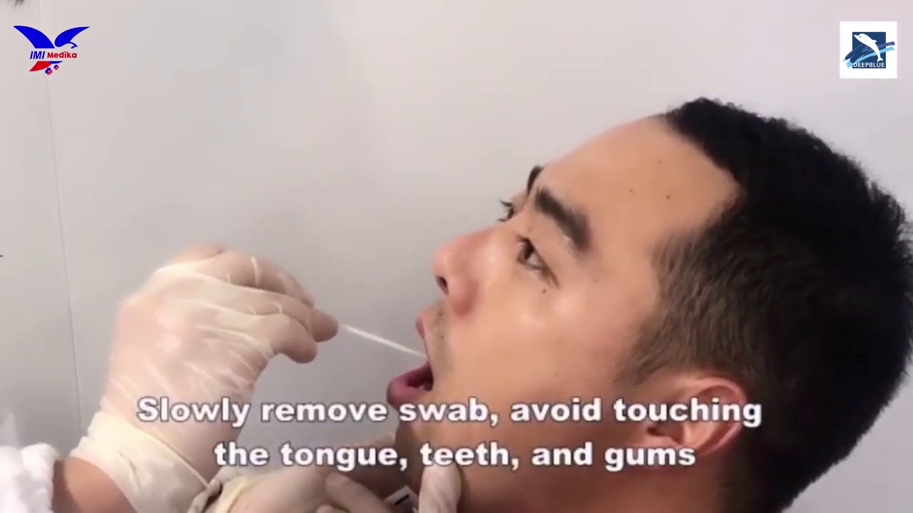 Anhui Deepblue - How To Use Antigen Test Kit - YouTube