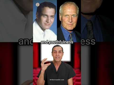 Did Paul Newman Have Plastic Surgery