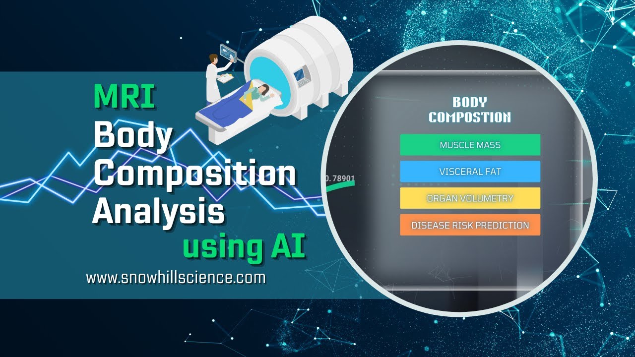 MRI Body Composition Analysis - YouTube