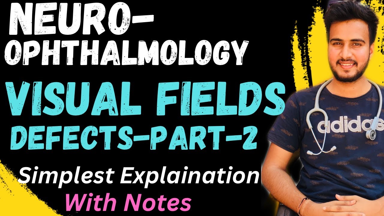 Visual Field Defect~2//Lesions Of Visual Pathway//NEURO~OPHTHALMOLOGY ...