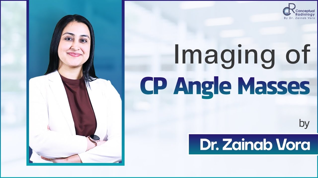 Imaging Of CP Angle Masses by Dr. Zainab Vora | Radiology Residency ...