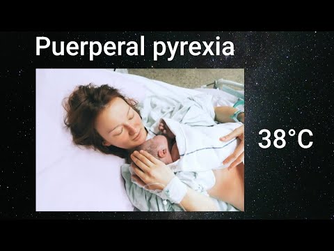 Puerperal pyrexia - YouTube