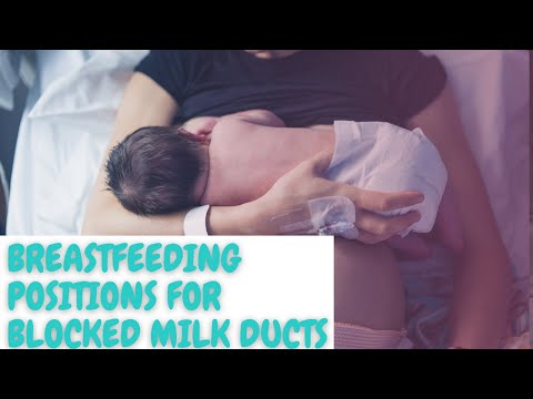 Breastfeeding Positions for Blocked Milk Ducts