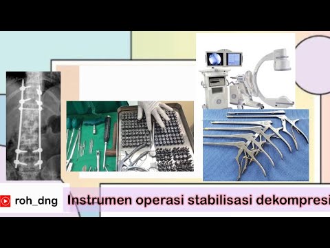 Stabilisasi dekompresi , spine bedah orthopedi || instrumen operasi ...