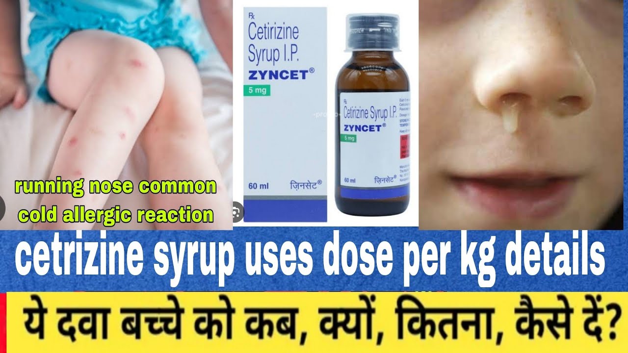 cetrizine syrup || running nose treatment | baby allergic reaction ...