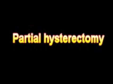 What Is The Definition Of Partial hysterectomy Medical School ...