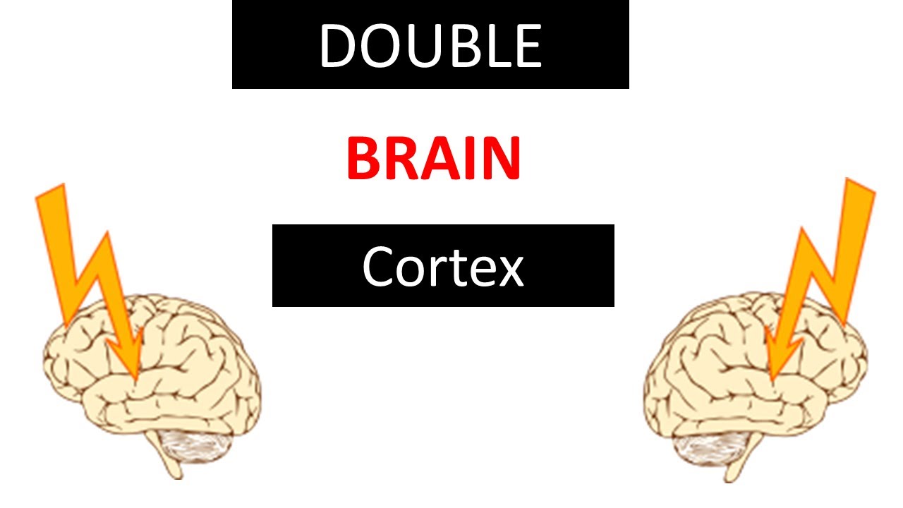 Double brain cortex? | Double Cortex Syndrome - YouTube