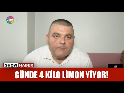 Günde 4 kilo limon yiyor!