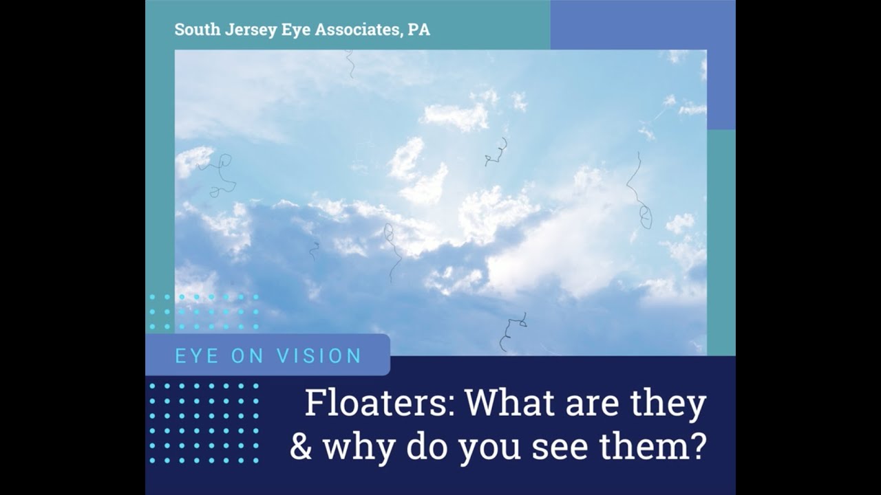 EYE ON VISION: Floaters - YouTube