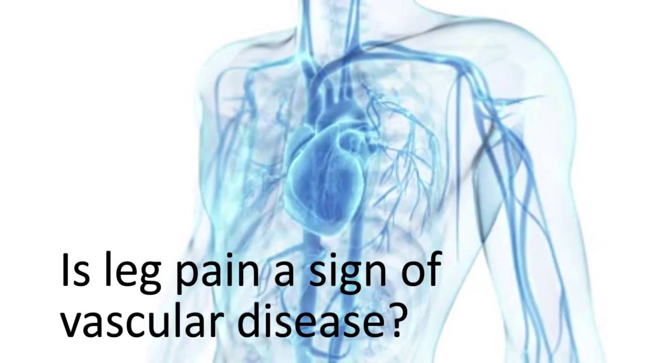 Ask a Cardiologist: Is leg pain a sign of vascular disease? - YouTube