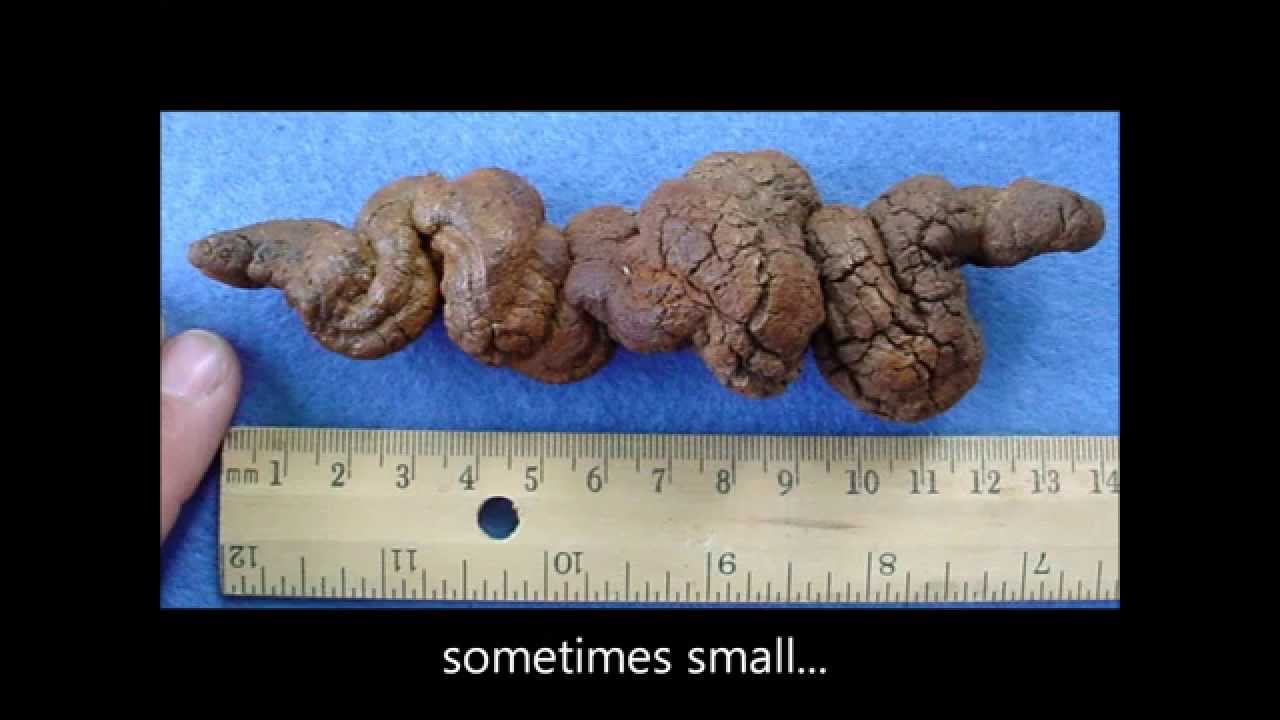 Do you have a coprolite or not? - YouTube