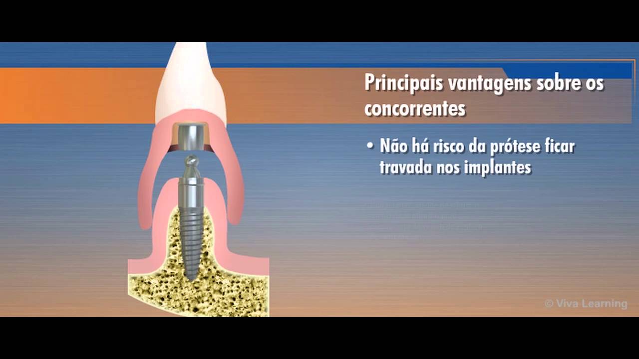 Quick Up | VOCO do Brasil - YouTube