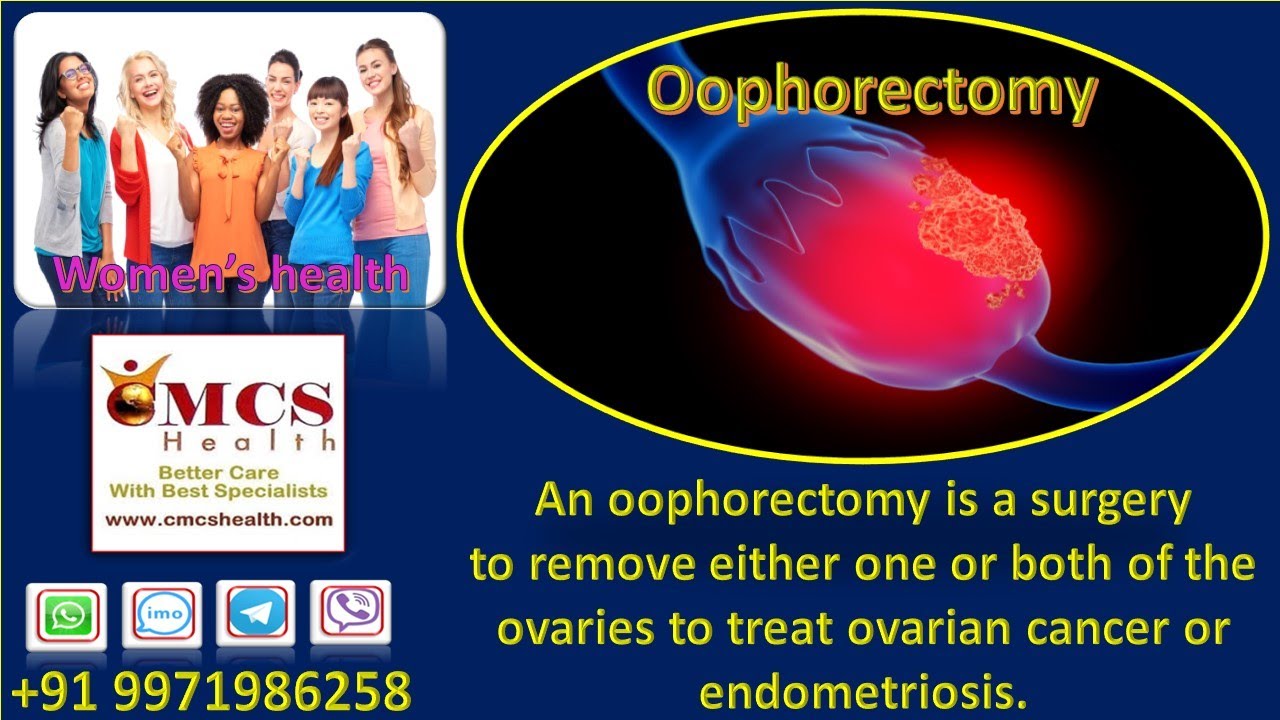 Oophorectomy (removal of ovary ) surgery - CMCS Health. - YouTube