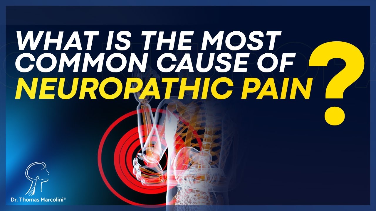 What are the main causes of nerve pain? - YouTube