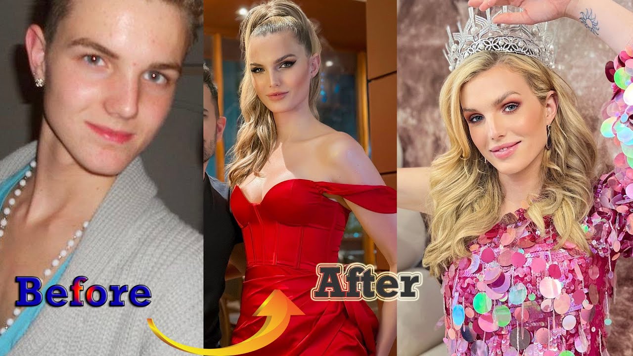 She continued to fight and win in her life | An inspiring story of the ...