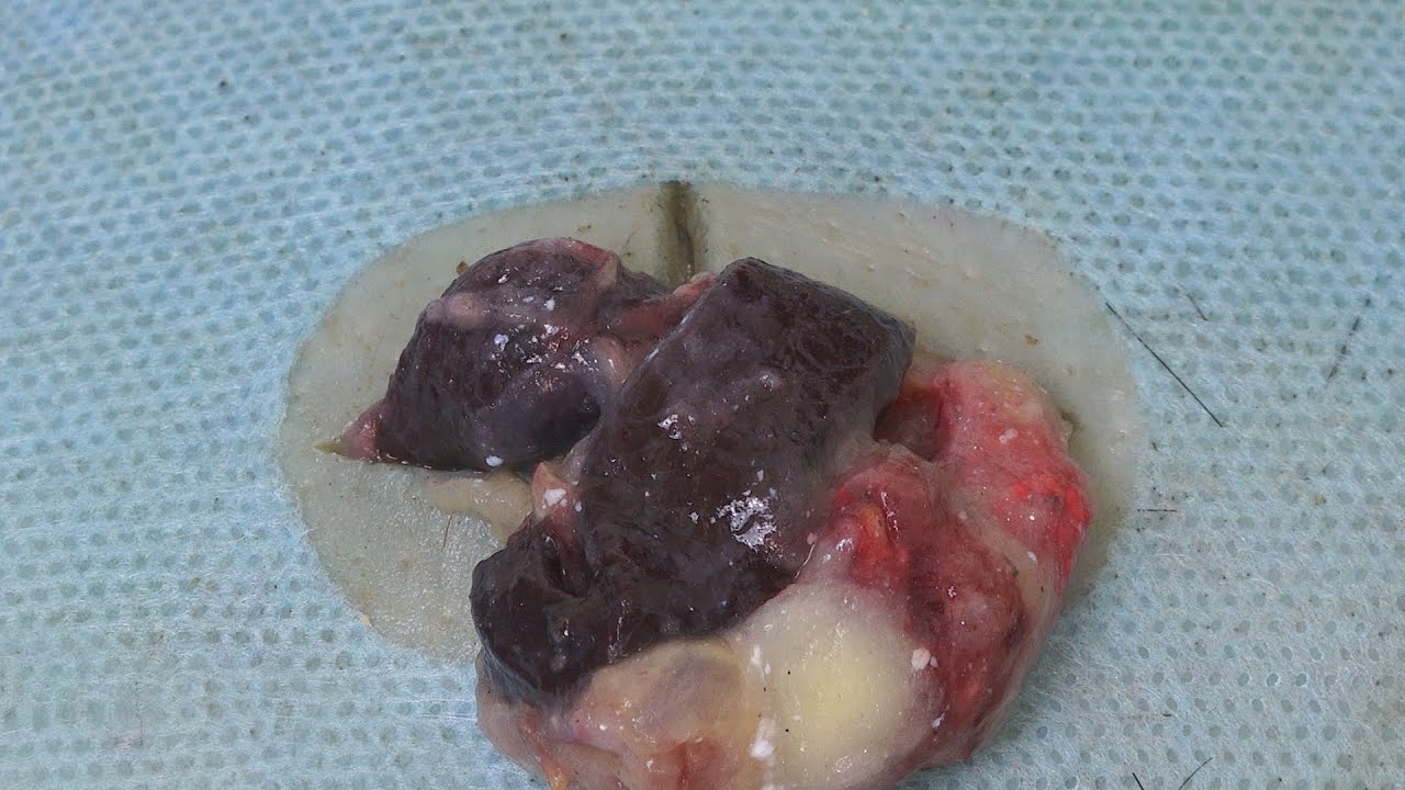 Dr. Lee Geoff Butler Enilsa MrPopZit 🌝 Professional pedicure process ...