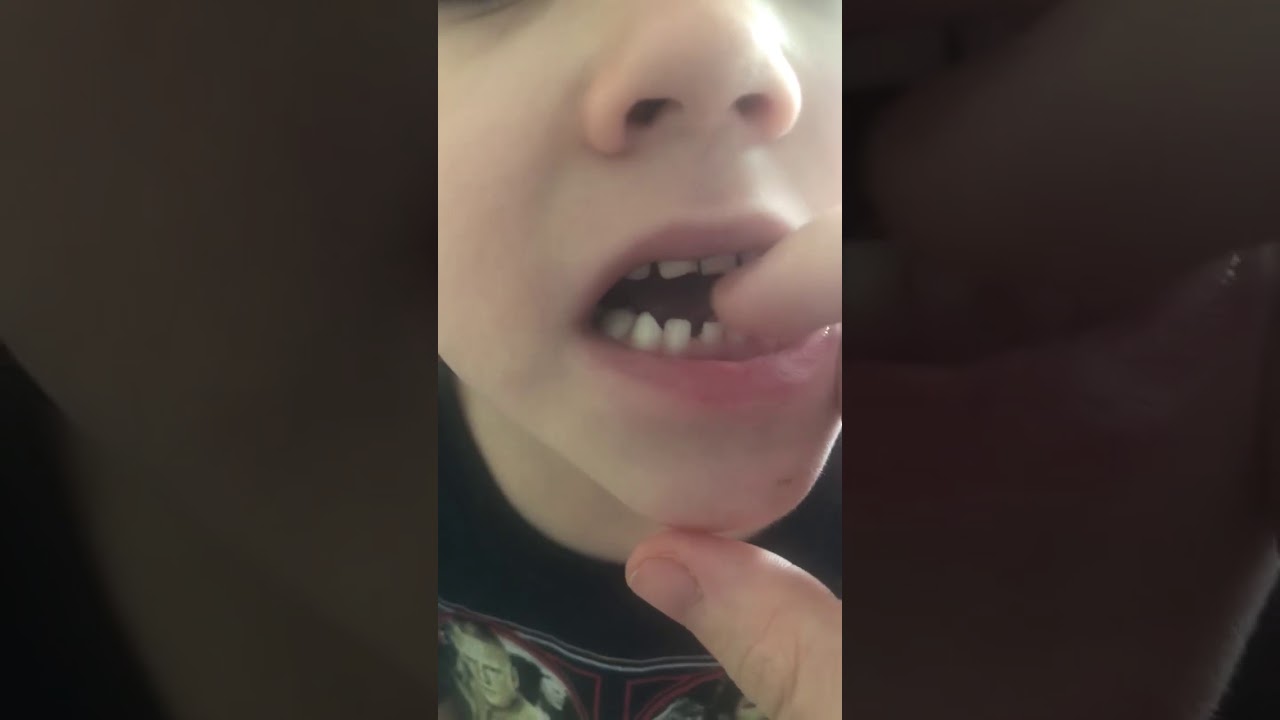His first loose tooth - YouTube