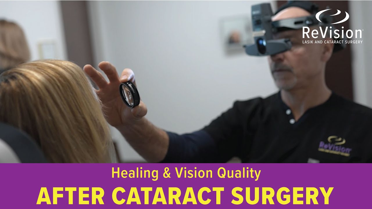 Recovery & Vision Expectations After Cataract Surgery - YouTube
