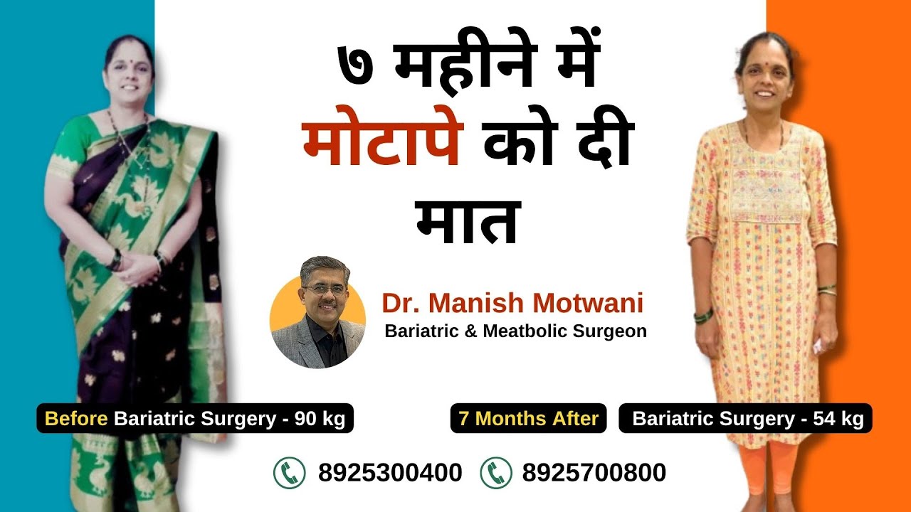 Bariatric Surgery Success Story in India (2024) - Mrs. Hemangi Madhivi ...