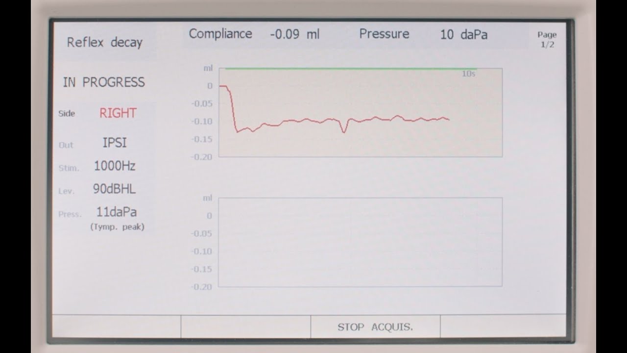Analizador Clínico de oído medio CLARINET de Inventis. Pruebas ...