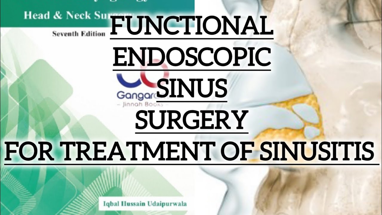 FUNCTIONAL ENDOSCOPIC SINUS SURGERY |TREATMENT OF SINUSITIS| - YouTube