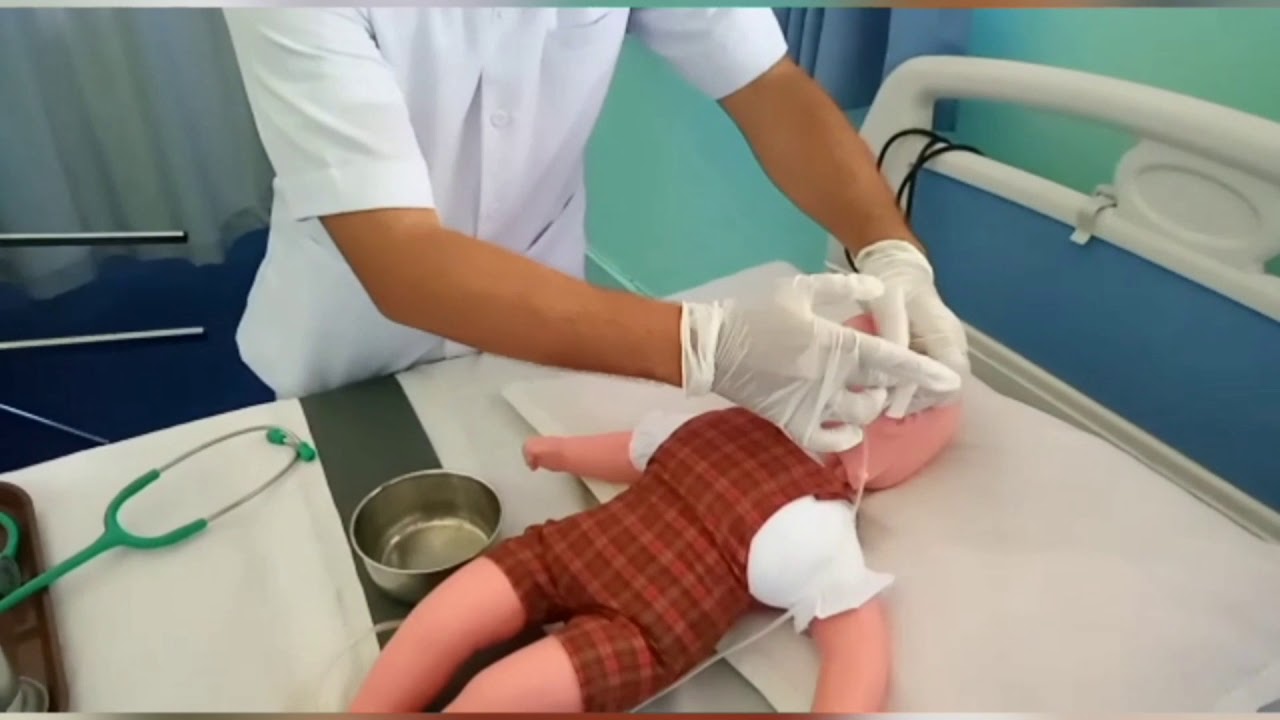 Tugas Keperawatan Anak 1 Tentang Pemasangan OGT Pada Bayi - YouTube