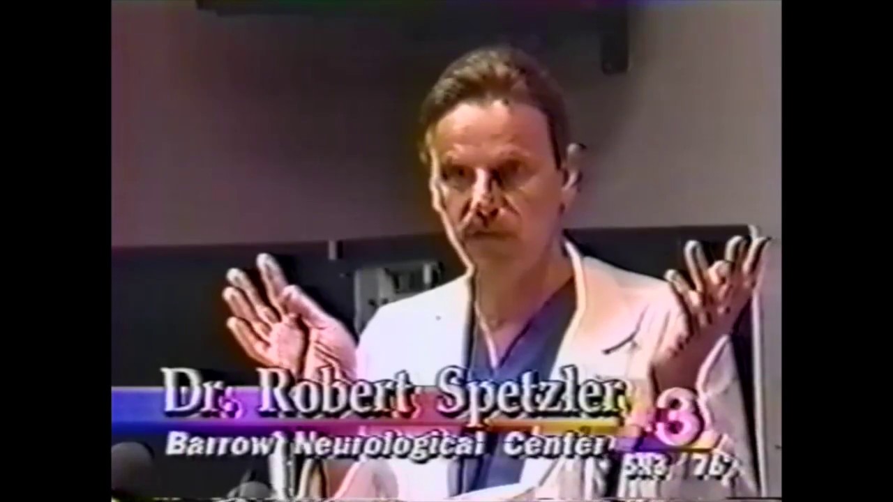 Dr. Robert Spetzler media highlights (short version) - YouTube