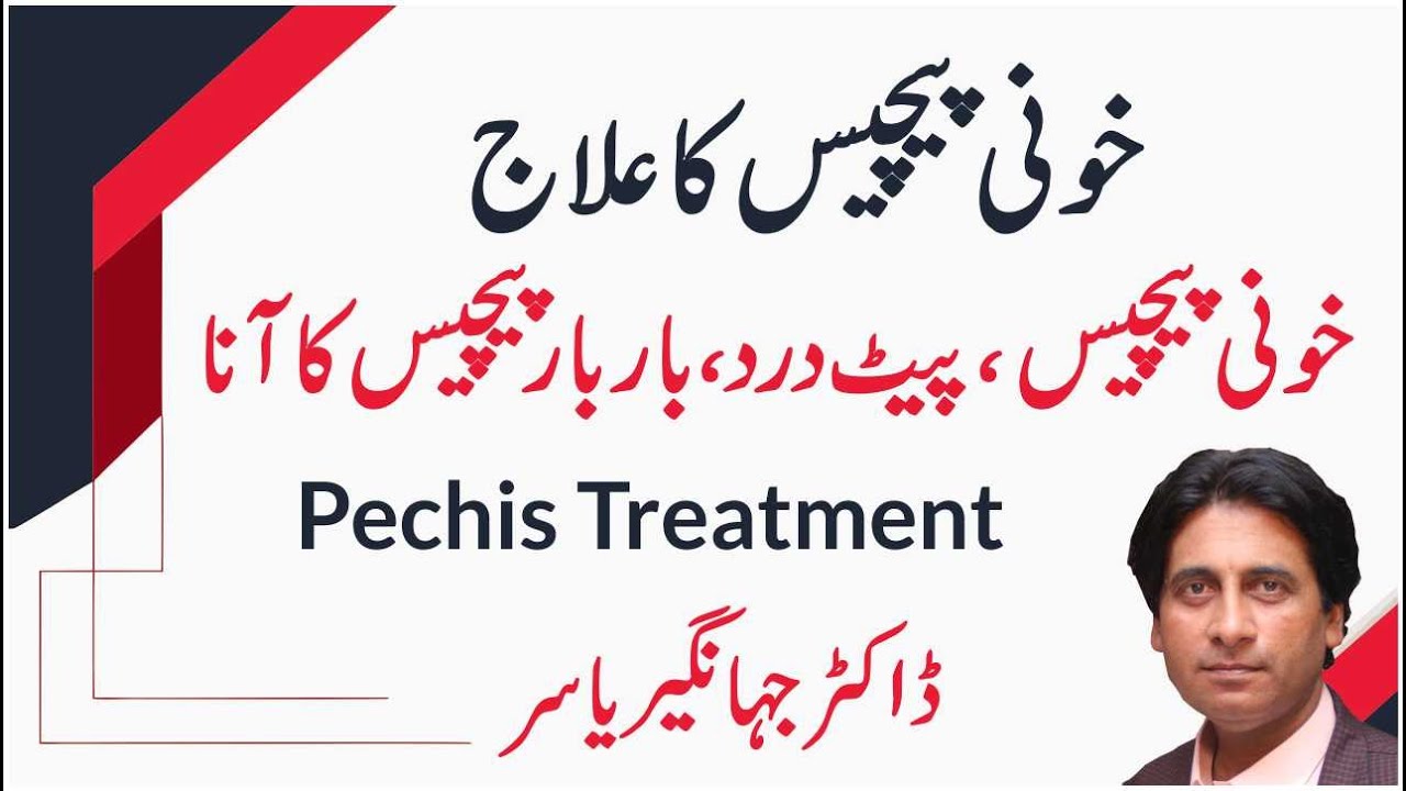 Khooni pechis ka ilaj | Pechis ka ilaj | Bar Bar pechis ka ana | DR ...