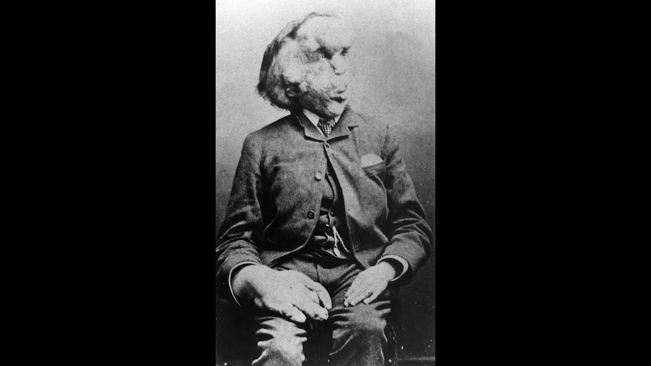 Happy anniversary brother honouring Joseph Merrick part two - YouTube