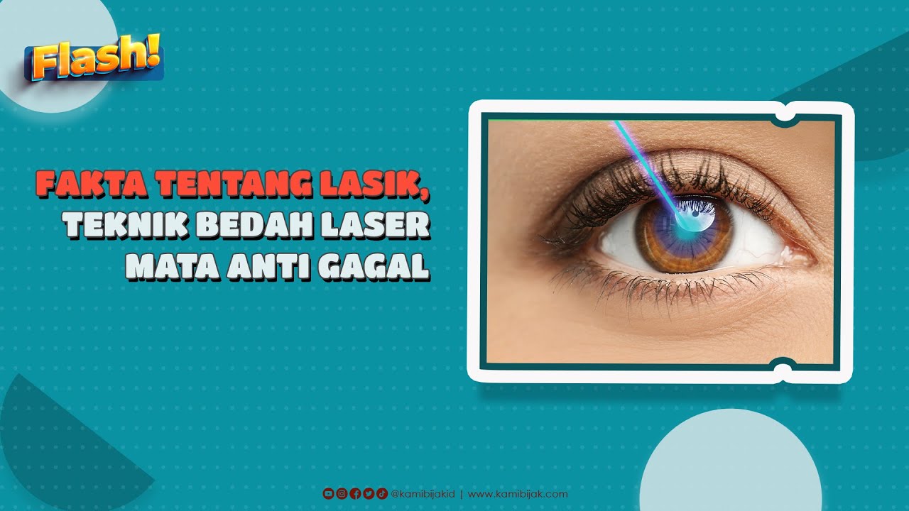 Fakta tentang Lasik, Teknik Bedah Laser Mata Anti Gagal - YouTube