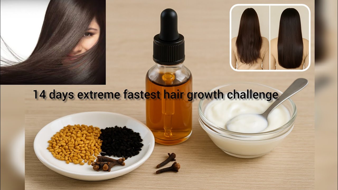 14 Days Extreme Hair Growth Challenge | Strongest Ingredients to Grow ...