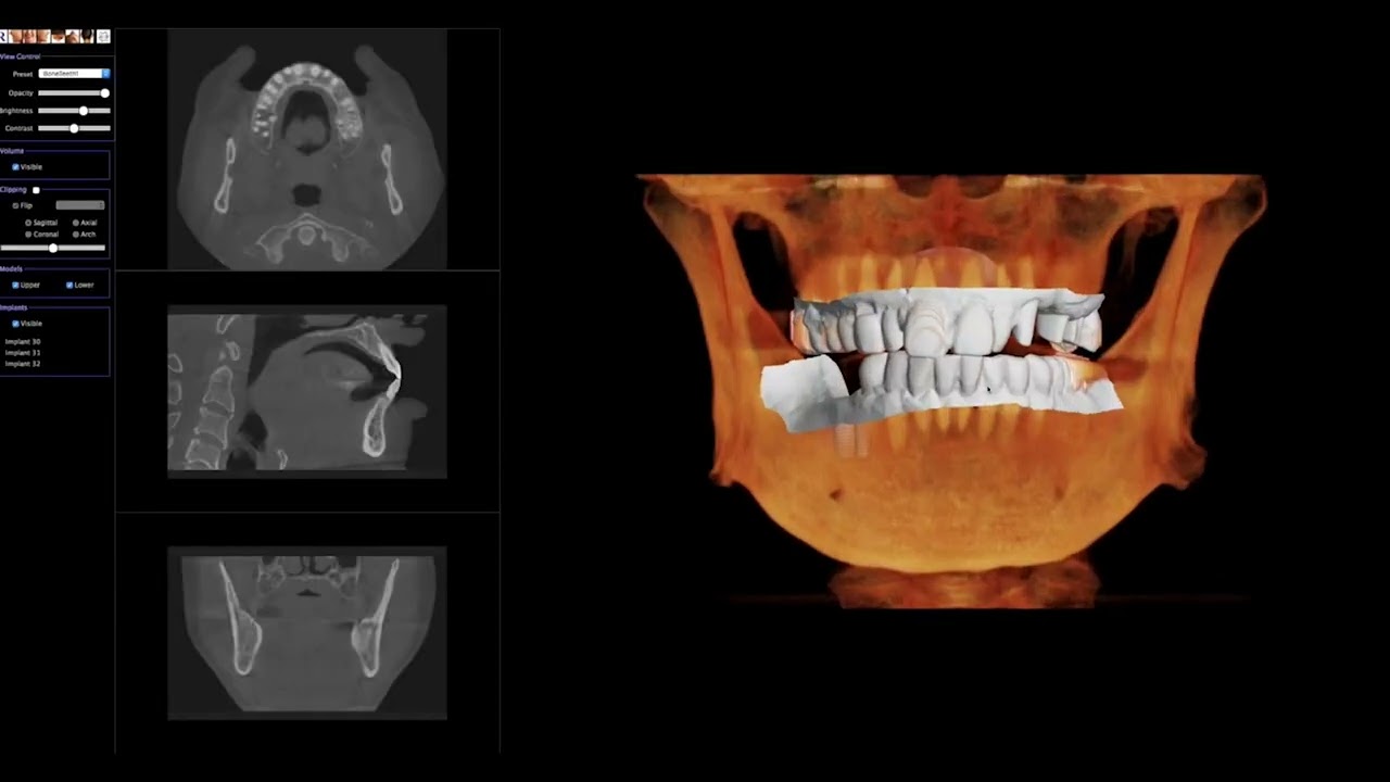 Invivo Workspace viewer - YouTube