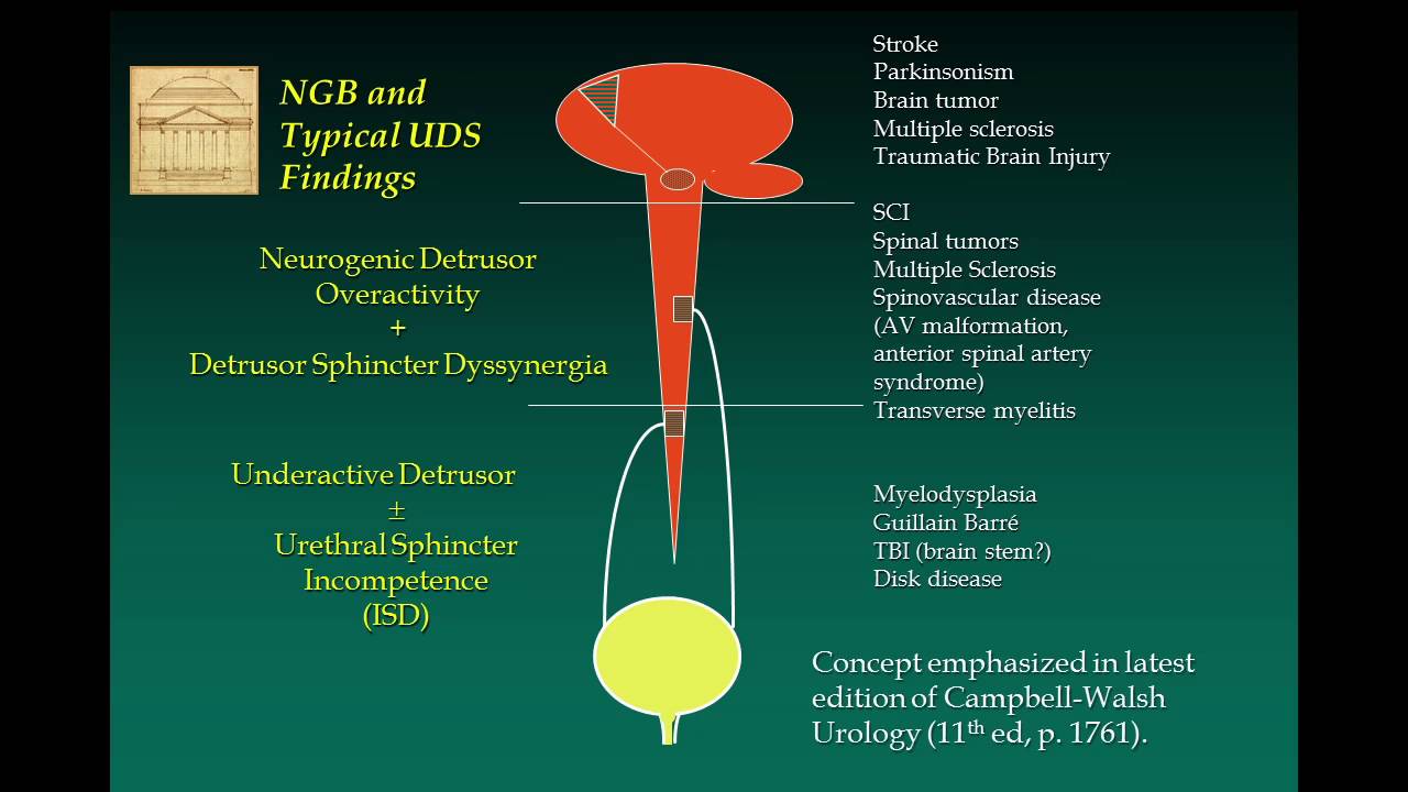 Traces: Understanding Urodynamic Findings Talk 3 - YouTube