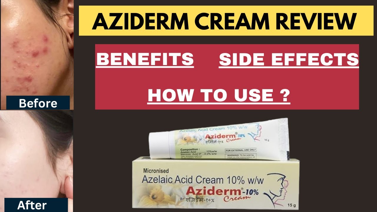 Aziderm cream review| Aziderm cream Benefits, Uses & Side effects ...