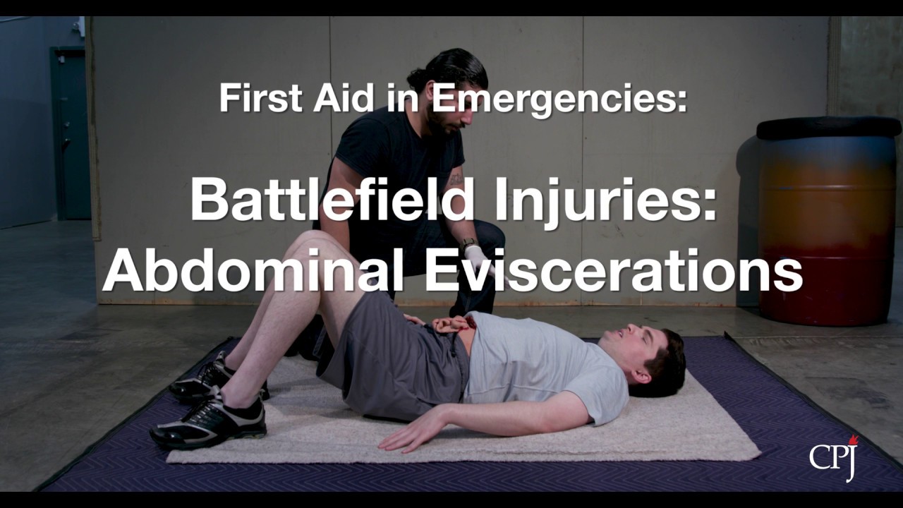 9b. Battlefield Injuries: Abdominal Eviscerations - YouTube