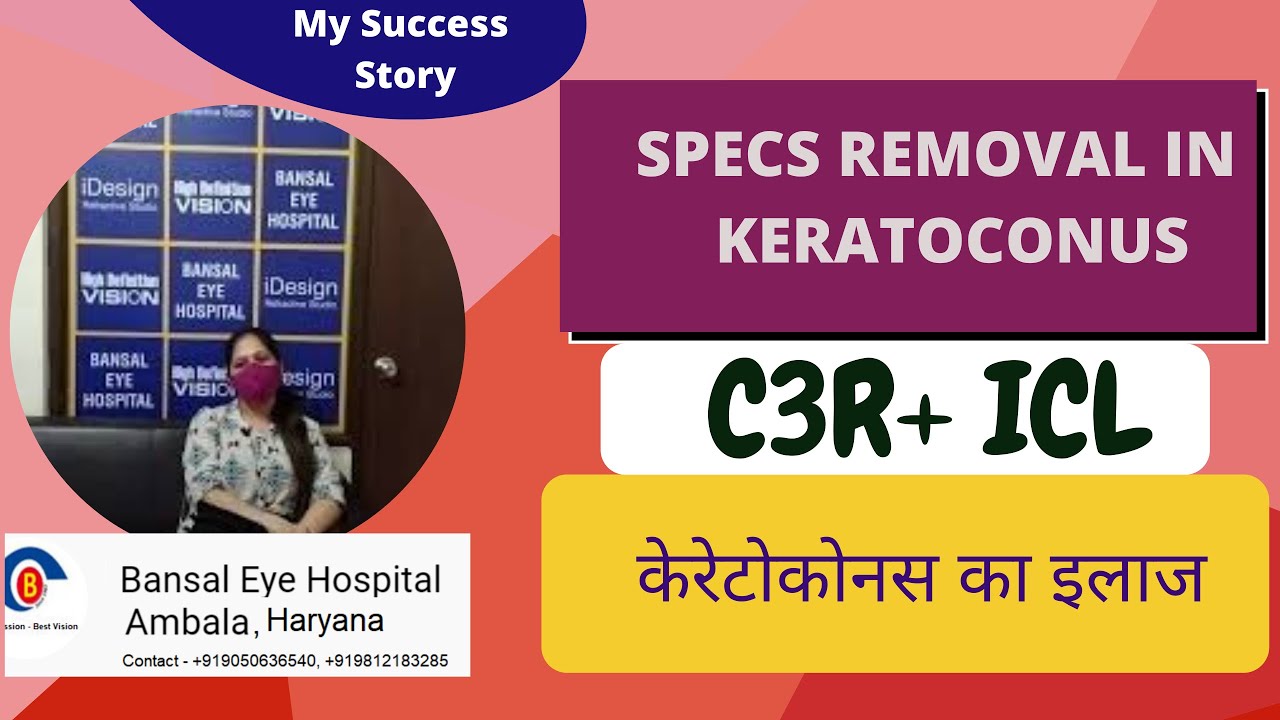 C3R And ICL Eye Surgery For Keratoconus | Patient From Gurgaon Review ...