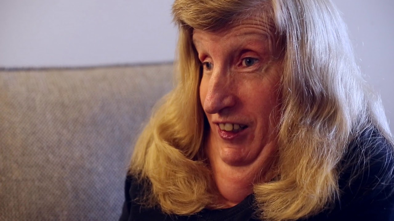 Growing up with a facial difference. - YouTube