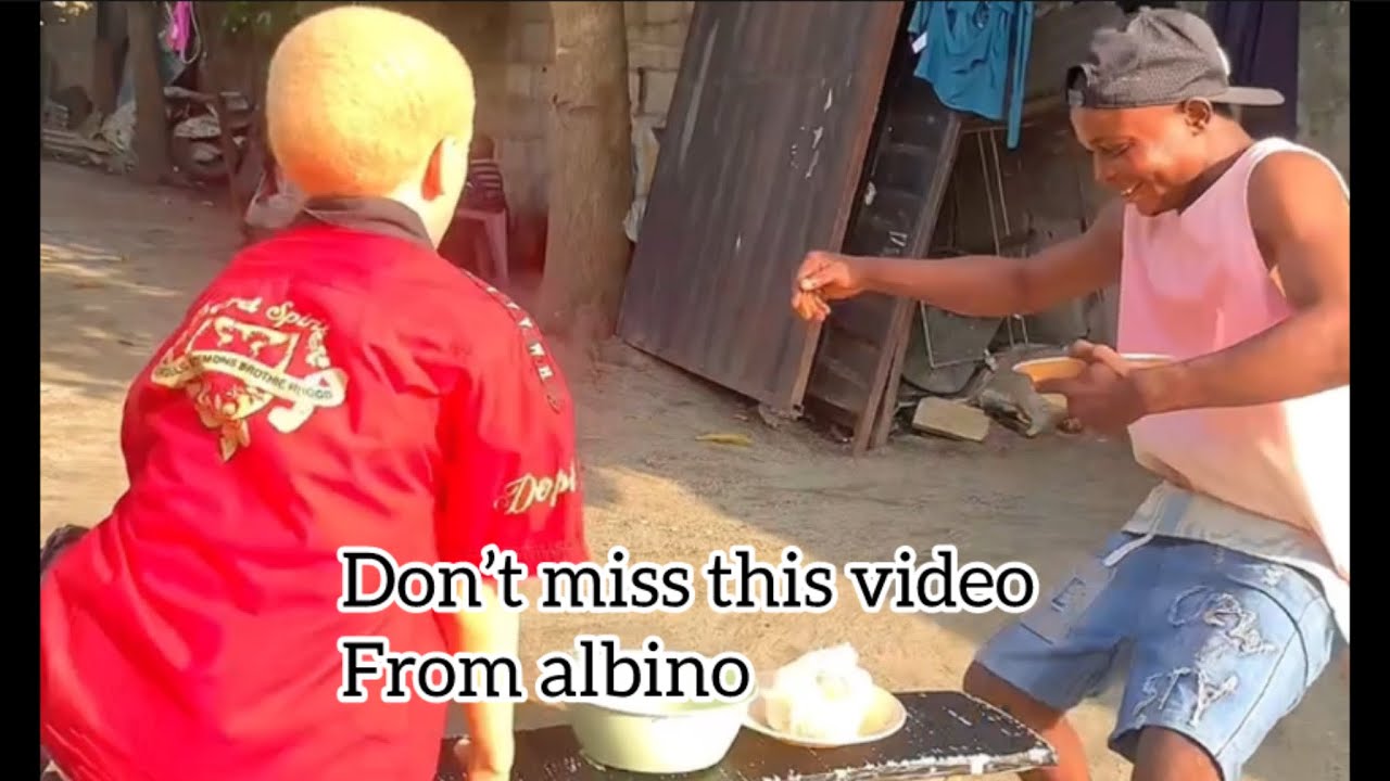 Is true Albinos can’t see when the sun rises - YouTube