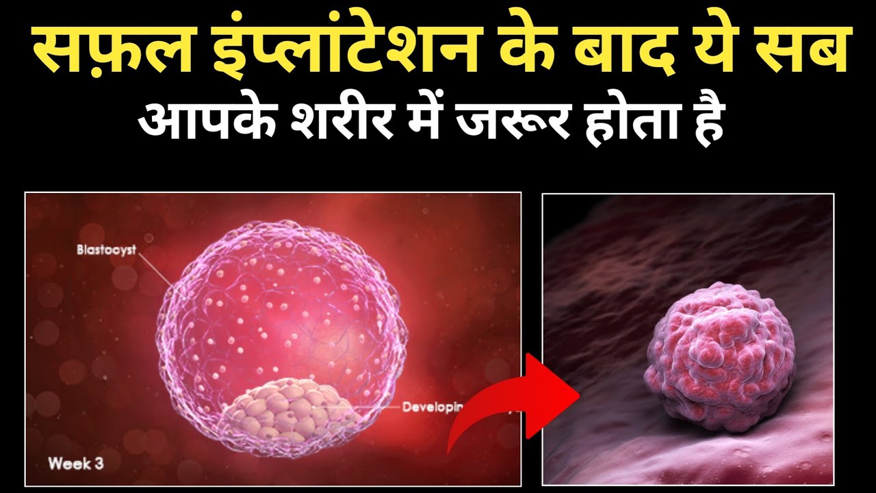 sucessful-implantation-symptoms-successful-implantation