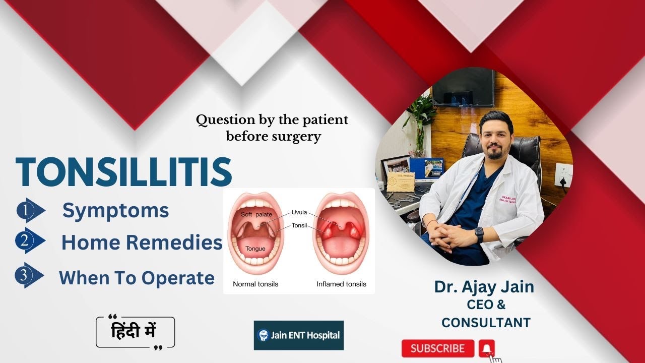 Tonsils (symptoms, home remedies, surgery ) (हिंदीं)(Dr Ajay Jain ...