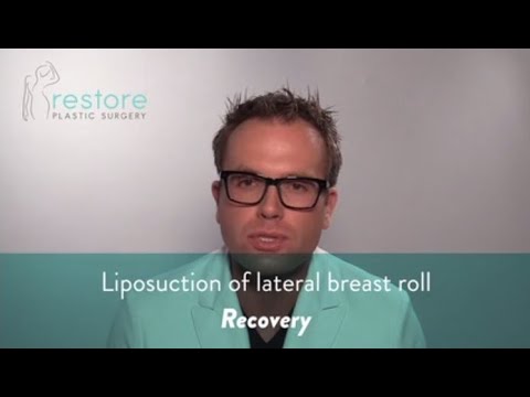 Dr. Benjamin Brown, Plastic Surgeon - Liposuction of lateral breast ...