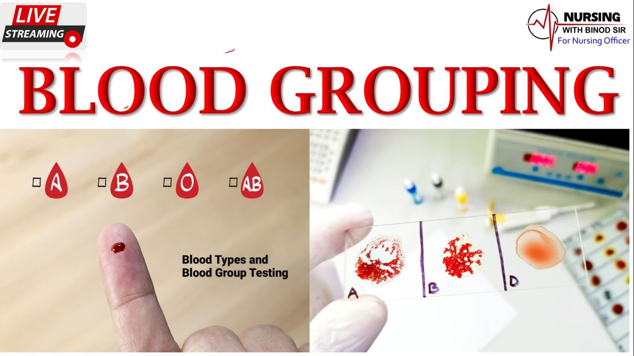 Blood Group II Interpretation II Blood group II A+ve II Procedure II ...