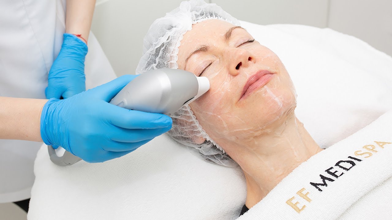 EF MEDISPA | 3D SKINLIFT BY ULTRAFORMER #EFMEDISPA - YouTube