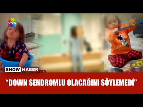 ''Sağlıklı'' dedi, down sendromlu doğdu!
