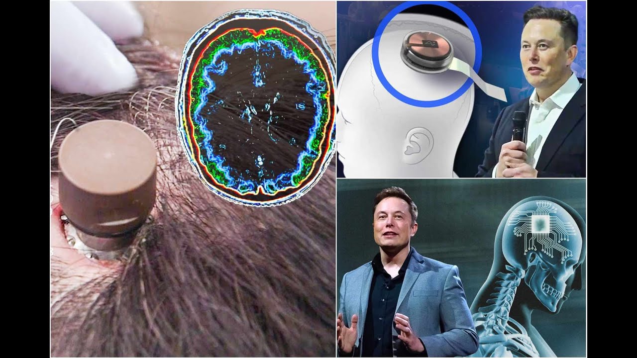 Elon Musk shows off updates to his brain chips - YouTube
