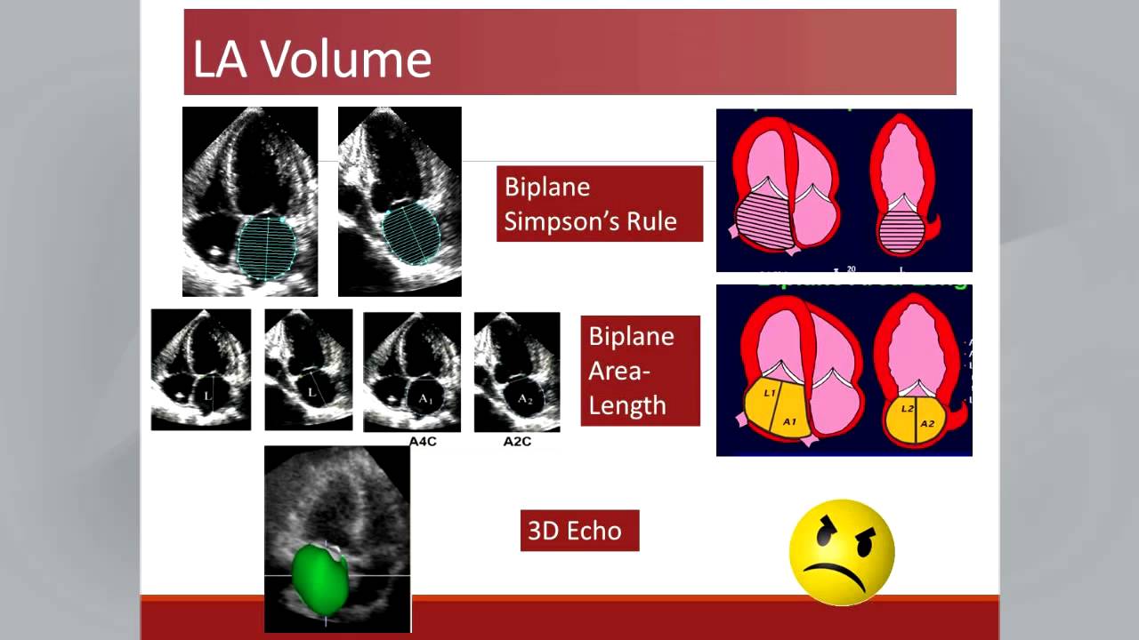 Spanish Translation: Chamber Quantification by Echocardiography in ...