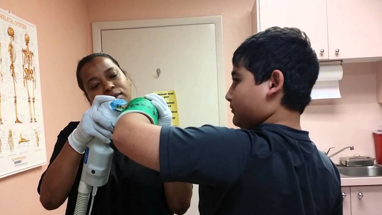 Taking off my cast! - YouTube