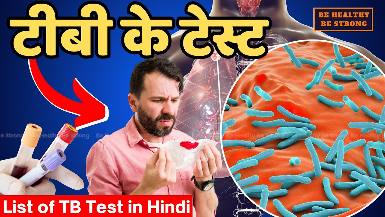 Top TB Tests | टीबी में किये जाने वाले टेस्ट के बारे में जाने #tb # ...