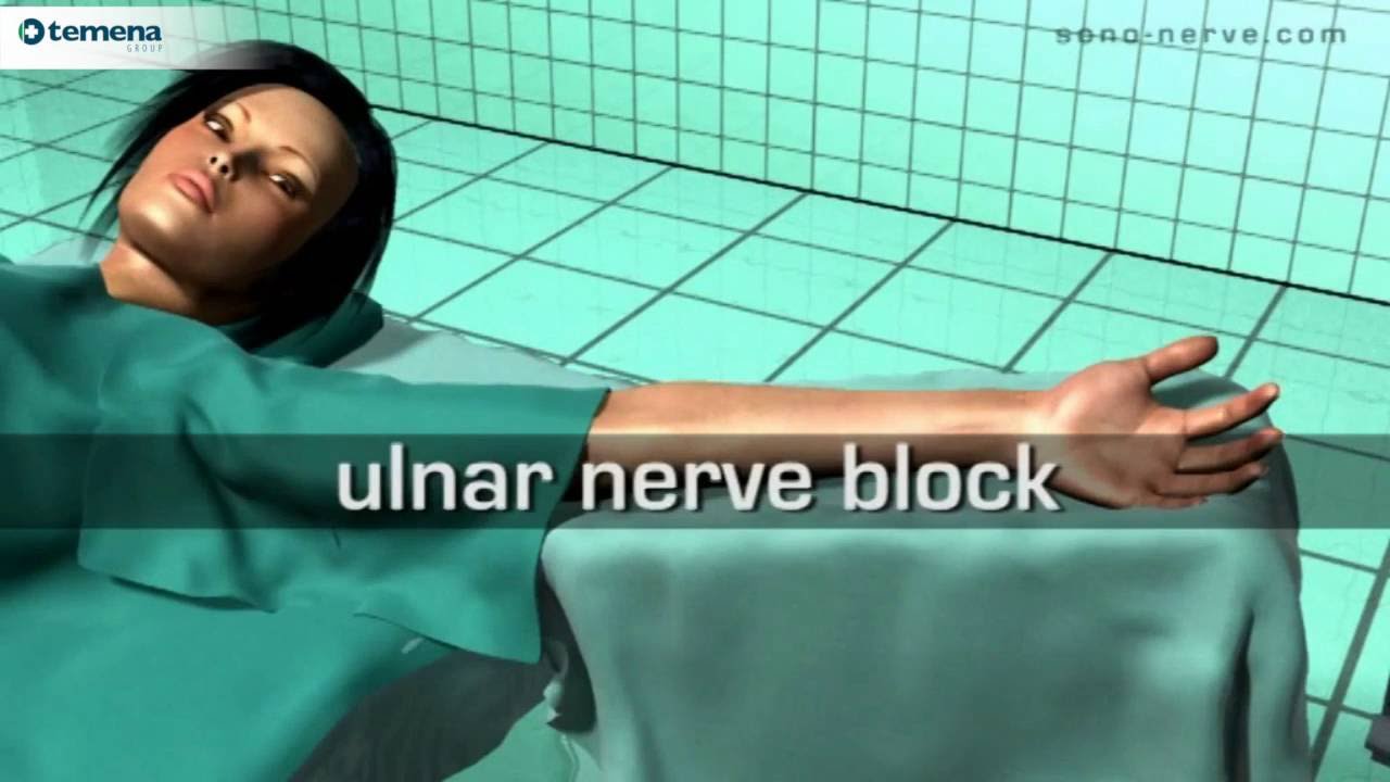 Ulnar nerve block - YouTube