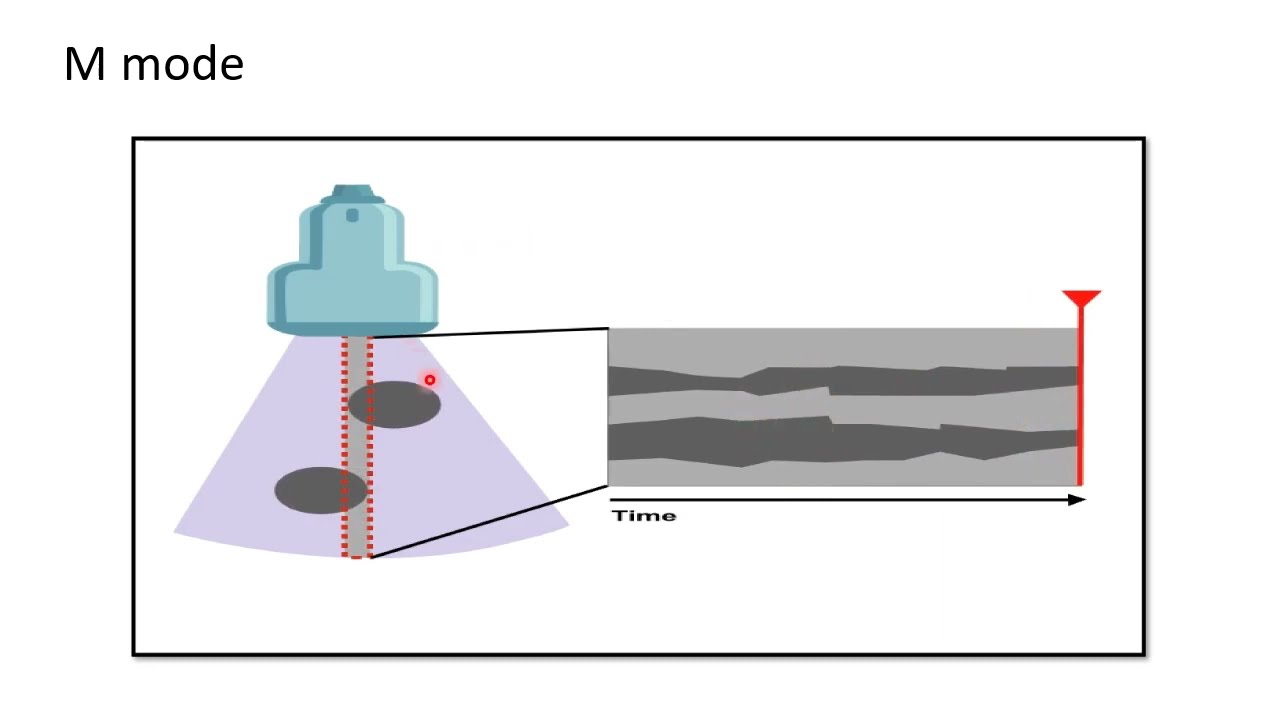 From US to Image: Ultrasound Modes - YouTube